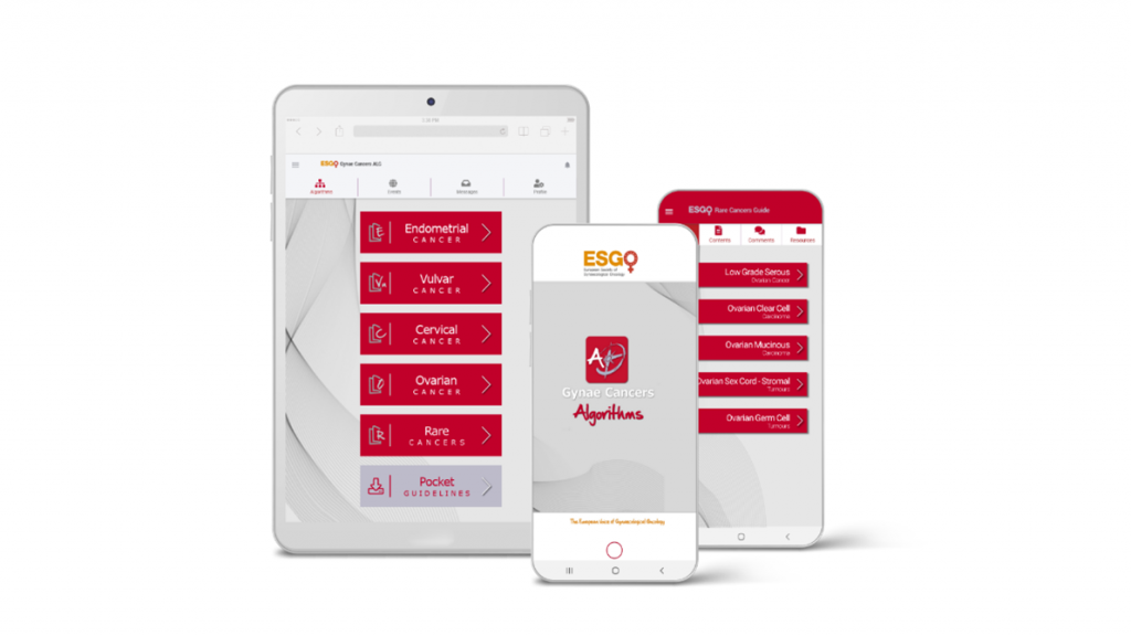 Clinical Calculators - ESGO - European Society of Gynaecological ...